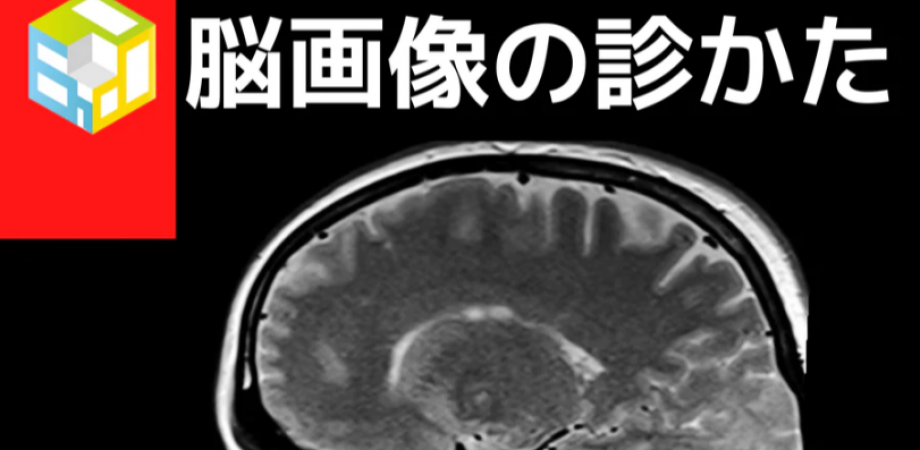 若手理学療法士・作業療法士のための脳画像の診かた｜基底核の知識と脳画像の結びつけ | Peatix