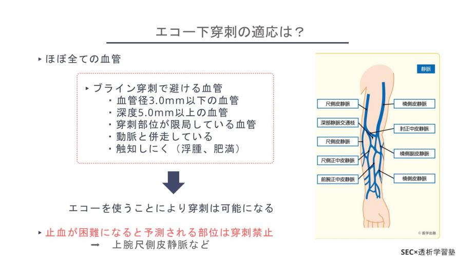 エコー下穿刺マスターへの道 ～120分で苦手意識ZEROに！～ | Peatix