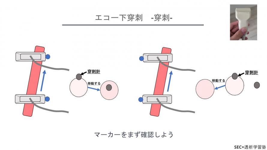 エコー下穿刺マスターへの道 ～120分で苦手意識ZEROに！～ | Peatix