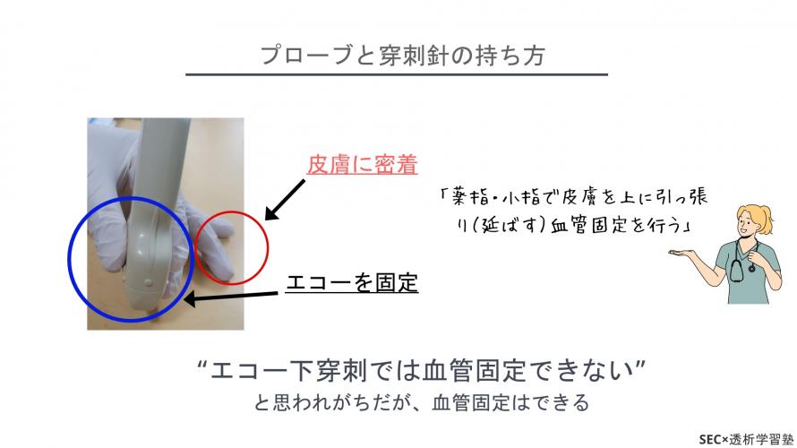 エコー下穿刺マスターへの道 ～120分で苦手意識ZEROに！～ | Peatix