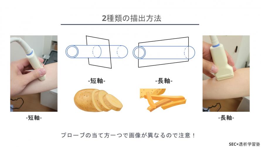 エコー下穿刺マスターへの道 ～120分で苦手意識ZEROに！～ | Peatix