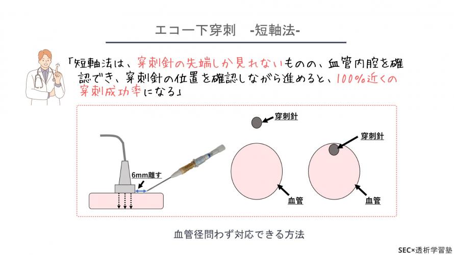 エコー下穿刺マスターへの道 ～120分で苦手意識ZEROに！～ | Peatix