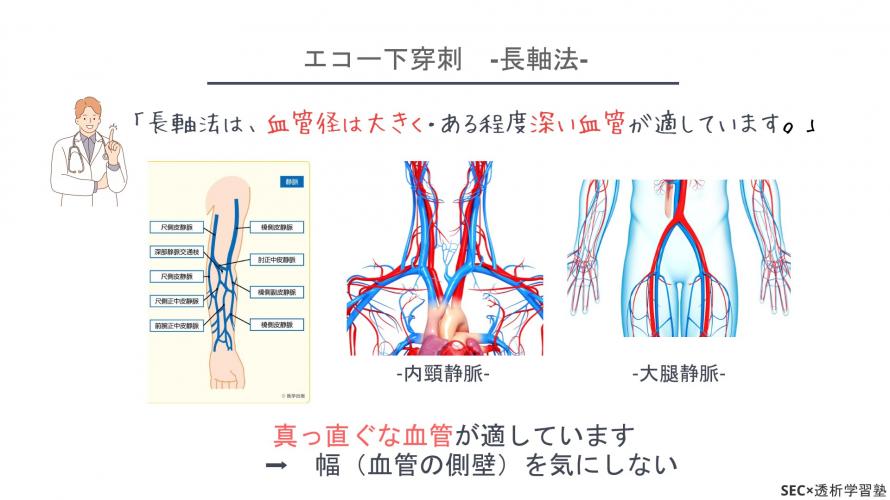 エコー下穿刺マスターへの道 ～120分で苦手意識ZEROに！～ | Peatix