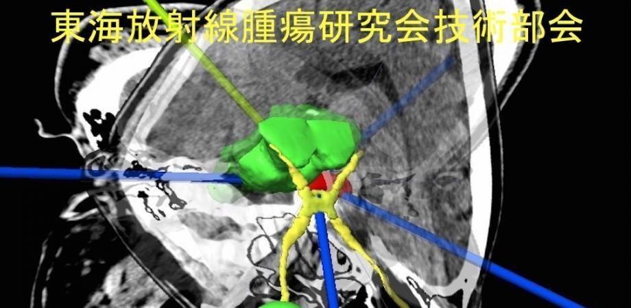 東海放射線腫瘍研究会 第67回技術部会（Web開催） | Peatix