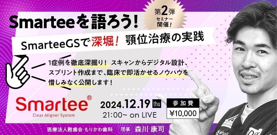 Smarteeを語ろう！【Smartee GS】を徹底解説 | Peatix