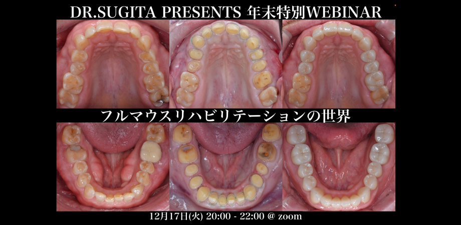 フルマウスリハビリテーションの世界 | Peatix