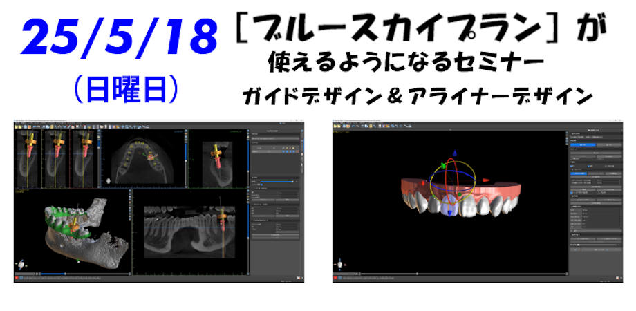 25/5/18 無料のサージカルガイド・デザインソフト【ブルースカイプラン】使い方セミナー (複製) | Peatix