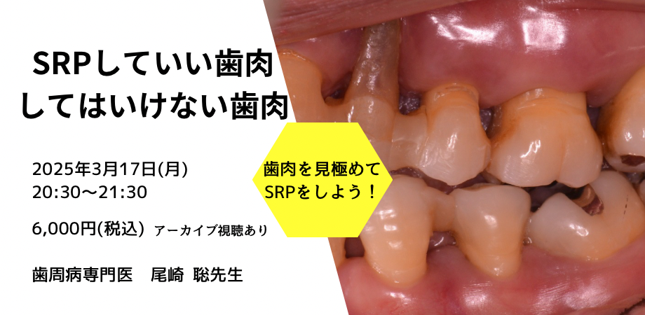 SRPしていい歯肉、してはいけない歯肉〜歯肉を見極めてSRPしよう〜 | Peatix