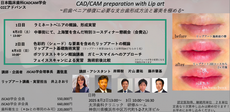CAD/CAM preparation with Lip art ~前歯ベニア修復に必要な支台歯形成方法と審美を極める CCCアドバンス 日本臨床歯科CADCAM学会 | Peatix