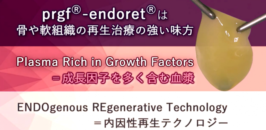 【オンデマンド配信】10分でサクッと学ぶPRGF-Endoret®（歯科領域) | Peatix