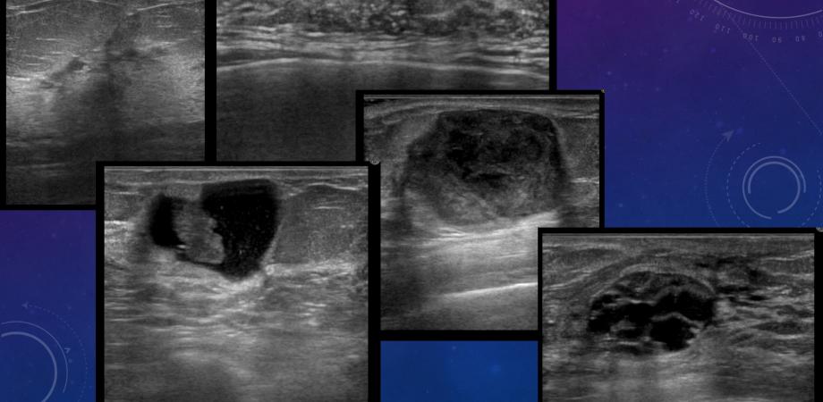 第76回広島乳腺超音波診断オープンカンファレンス（オンライン） | Peatix